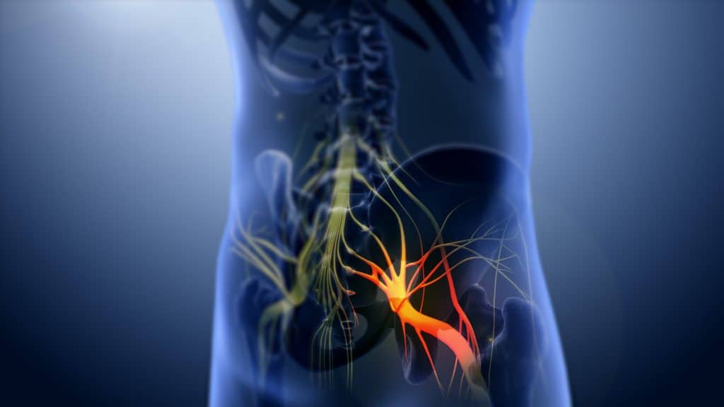 How a chiropractor can help with sciatica - Thorne Road Chiropractor